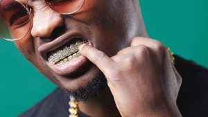 Diamond Grillz: Everything You Need to Know - Diamond101